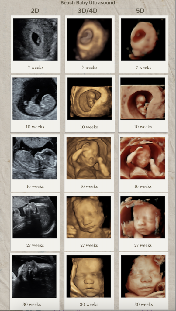 Beach Baby 3D/4D Ultrasound – 3D/4D Baby Ultrasound